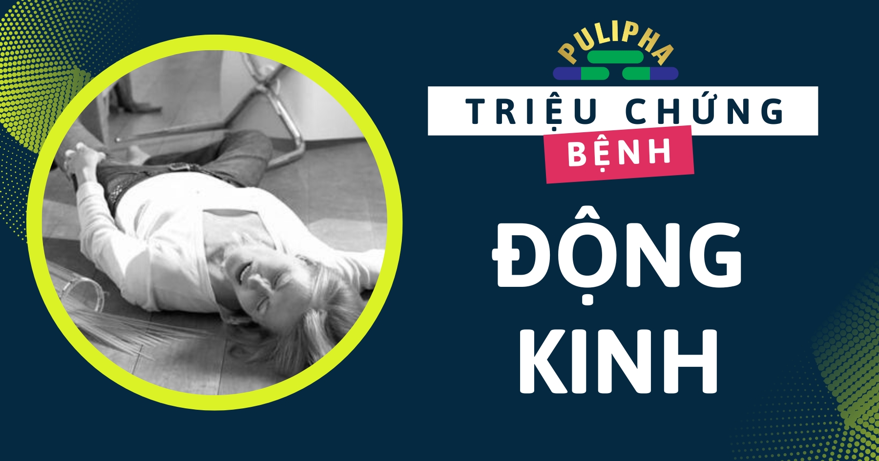 Triệu chứng của bệnh Động Kinh - 2022